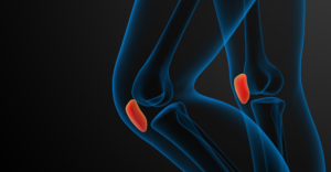 Rx Assiali di Rotula nei Centri del Medical Group Italia