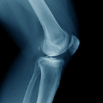 Rx Assiali di Rotula nei Centri del Medical Group Italia