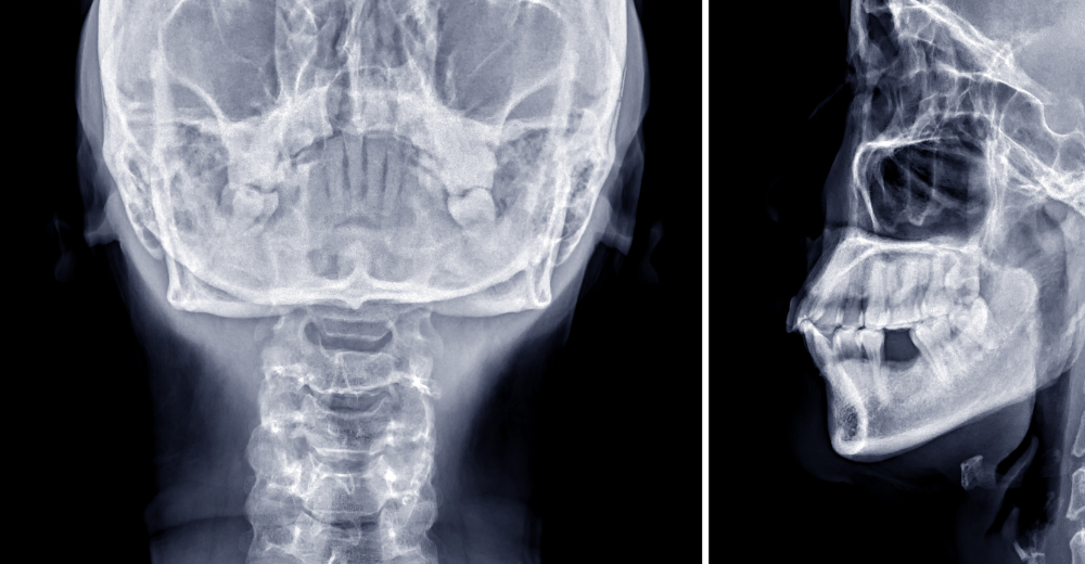 Esame Rx / Radiografia Orbite in uno dei Centri del Medical Group