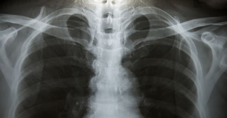 Esame Radiografia/Rx Torace in uno dei Centri del Medical Group