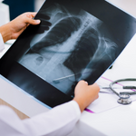 Esame Radiografia/Rx Torace in uno dei Centri del Medical Group