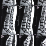 Esame RM Rachide Lombosacrale nei Centri del Medical Group