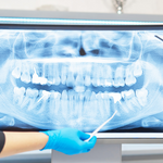 Esame TAC Dental Scan in uno dei Centri del Medical Group